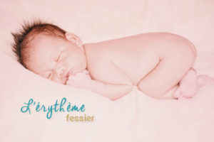 L'érythème fessier : de quoi s'agit-il ? | Berceau Magique